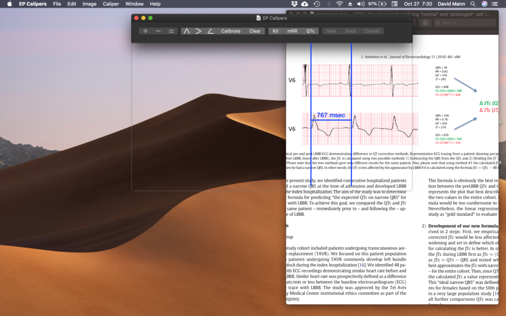 EP Calipers – EP Studios