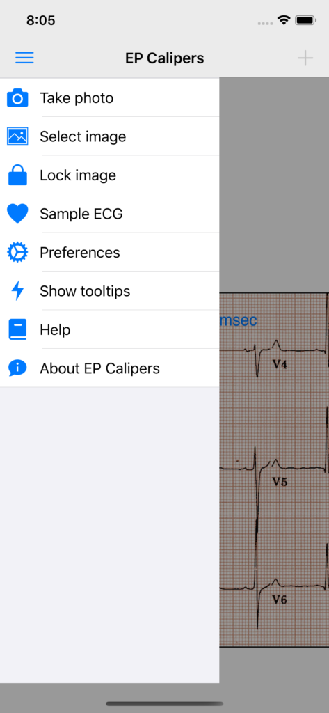 EP Calipers – EP Studios